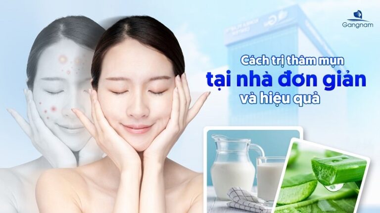 Top 8 cách trị thâm mụn tại nhà đơn giản và hiệu quả