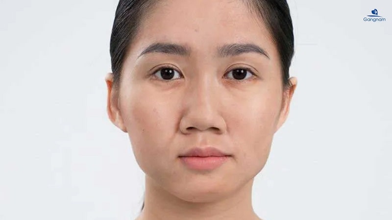 Mũi ngắn là gì? Tướng số mũi ngắn như thế nào?